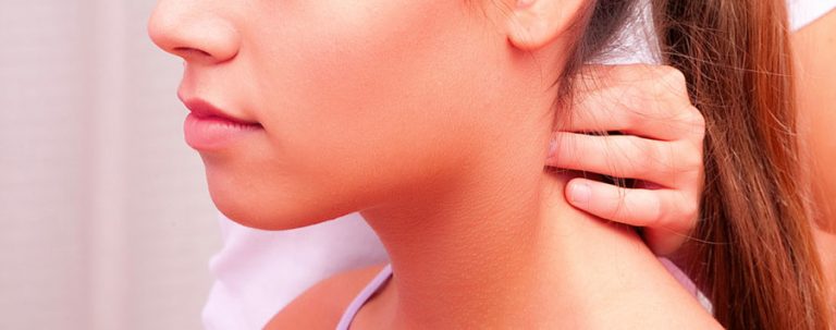 Botox en el cuello - Maxilodexeus