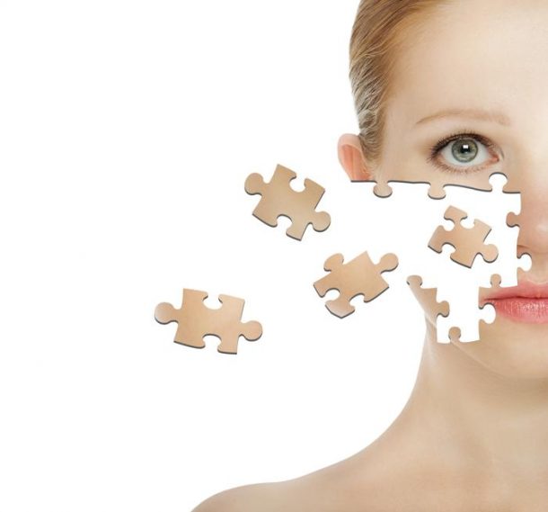 El estiramiento facial Micro-Lift - Maxilodexeus